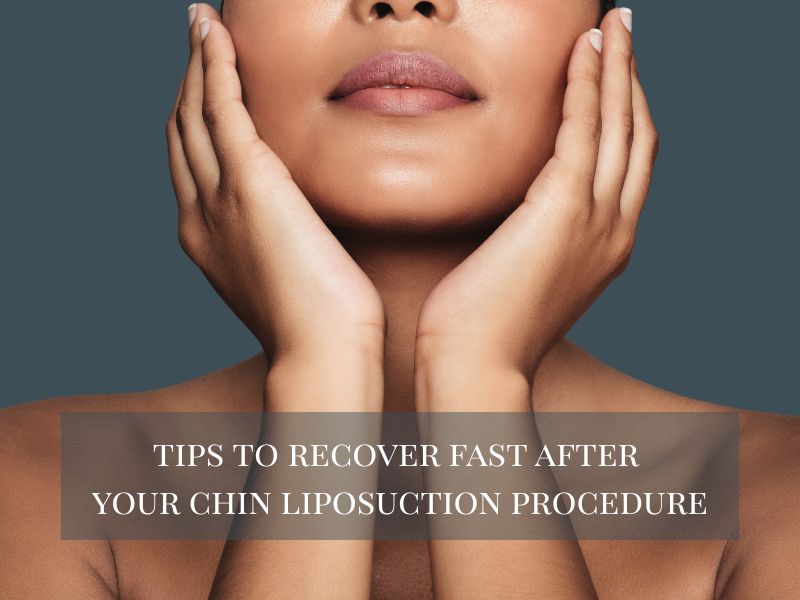 Chin Liposuction Recovery Day by Day: What to Expect | Aesthera Plastic ...